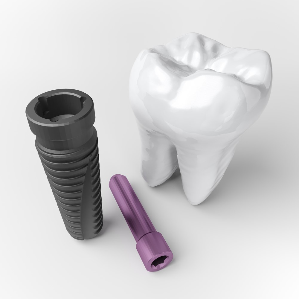 CREATING BEAUTIFUL TEETH FROM DENTAL IMPLANTS - Piney Point Oral ...